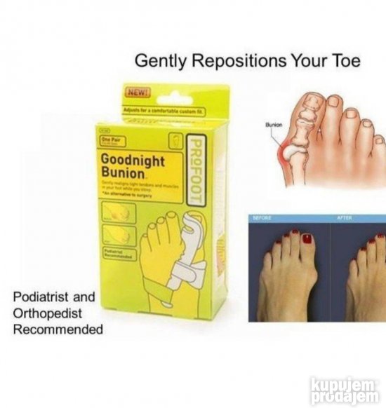 Longeta za ispravljanje cukljeva - KupujemProdajem