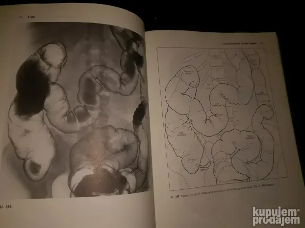 Anatomski atlas topografska i sistemska anatomija covjeka - KupujemProdajem